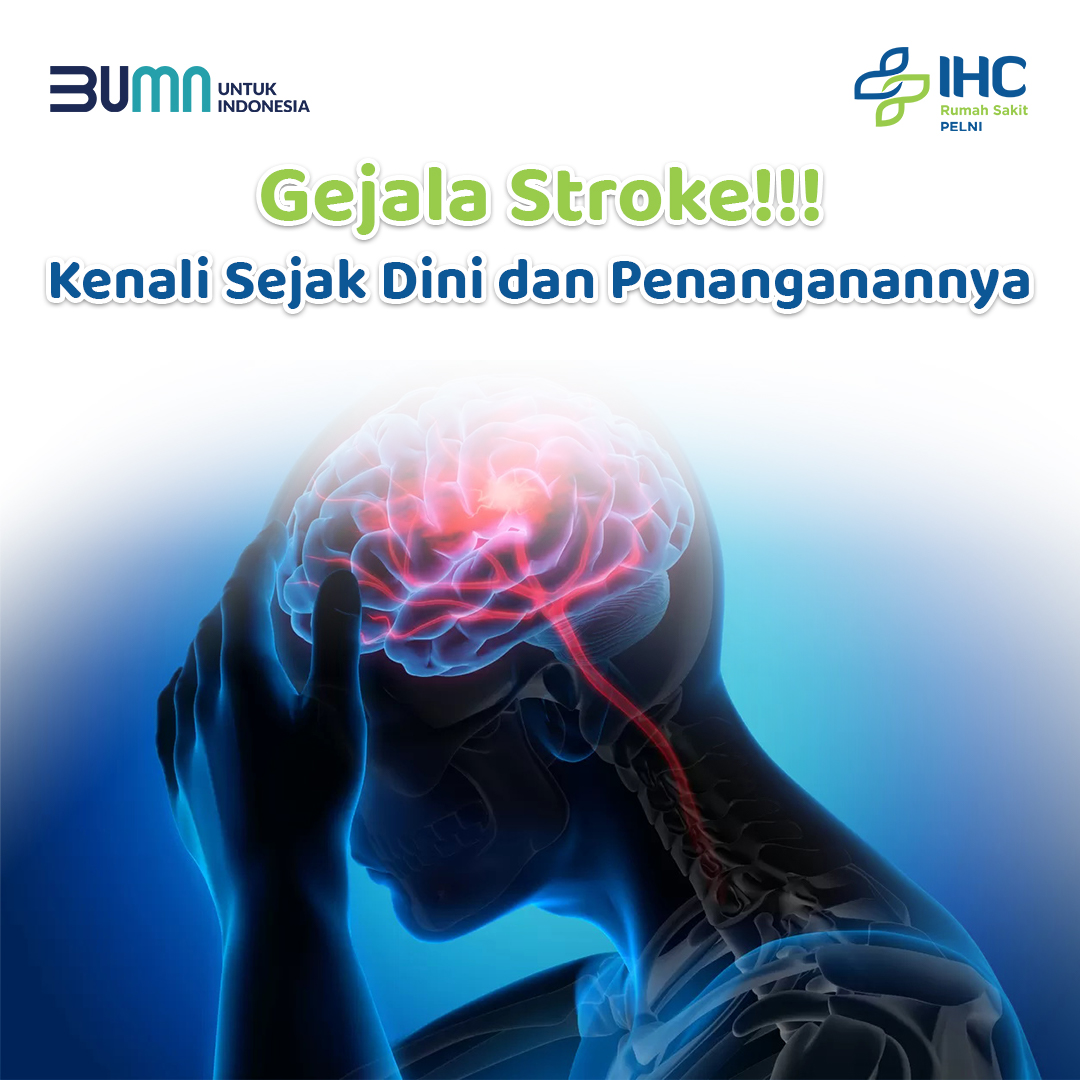 Kenali Gejala Stroke Sejak Dini dan Penanganannya - Rumah Sakit PELNI